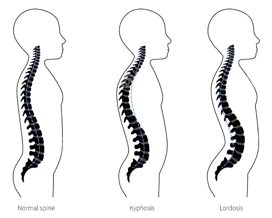Posture, Gait, & Integrated Biomechanics
