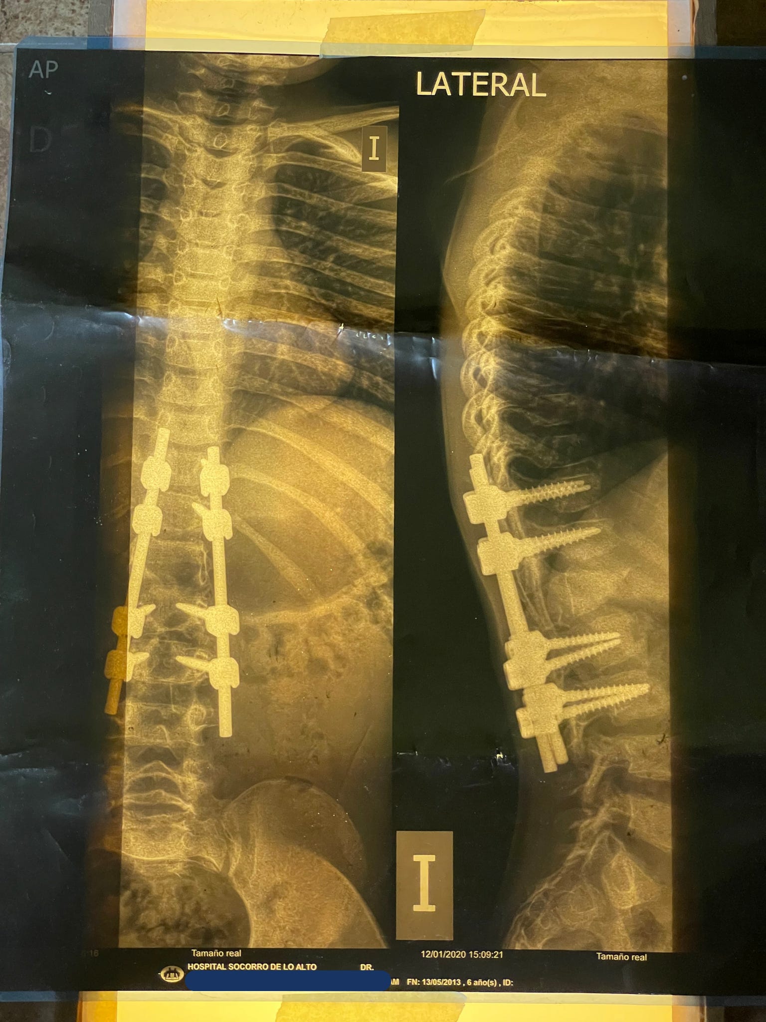 The Things They Carried: Is the Border Patrol discarding asylum seekers ...