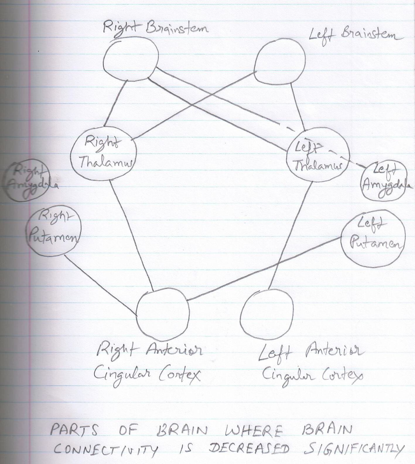 How decreased neuronal connections between specific brain areas ...