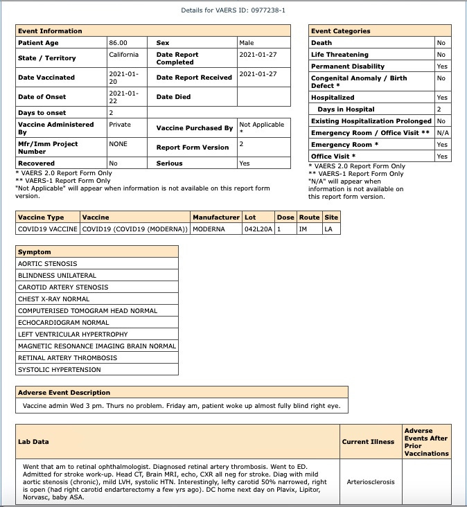 VAERS reports: eye related injuries, after vaccination with Pfizer ...