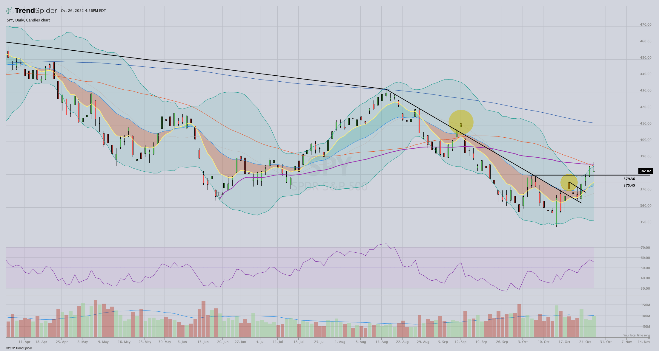 Score check - Bulls Vs. Bears - by Andrew Moss, CMT