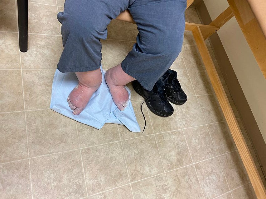 Only 1% of Heart Failure Patients Receive Optimal Medical Therapy at ...