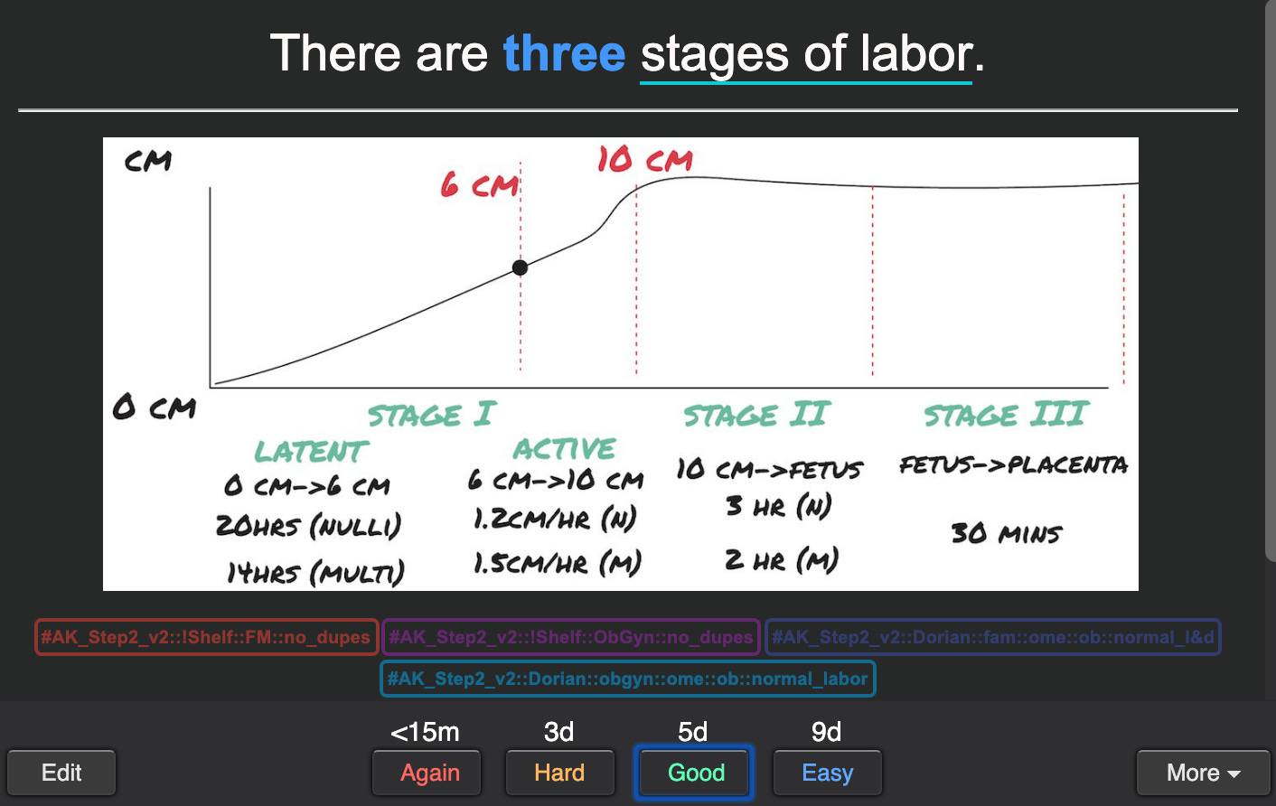 The Spaced Repetition Hype! - by Akiff Premjee