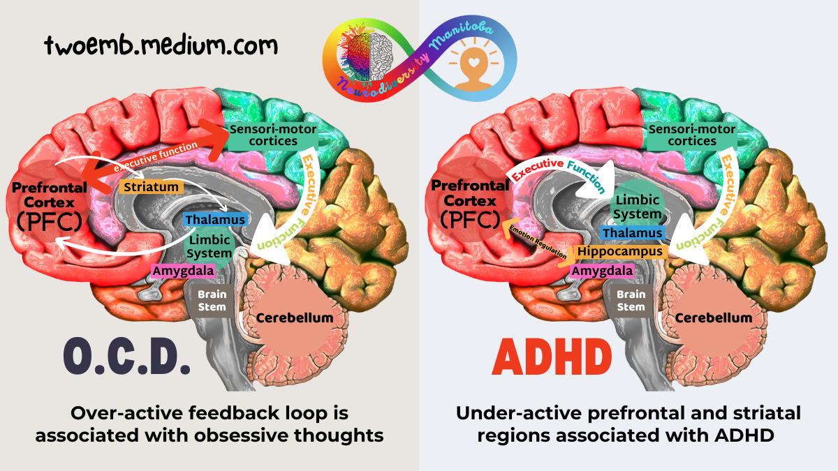 Why OCD Is Considered Highly Comorbid With ADHD