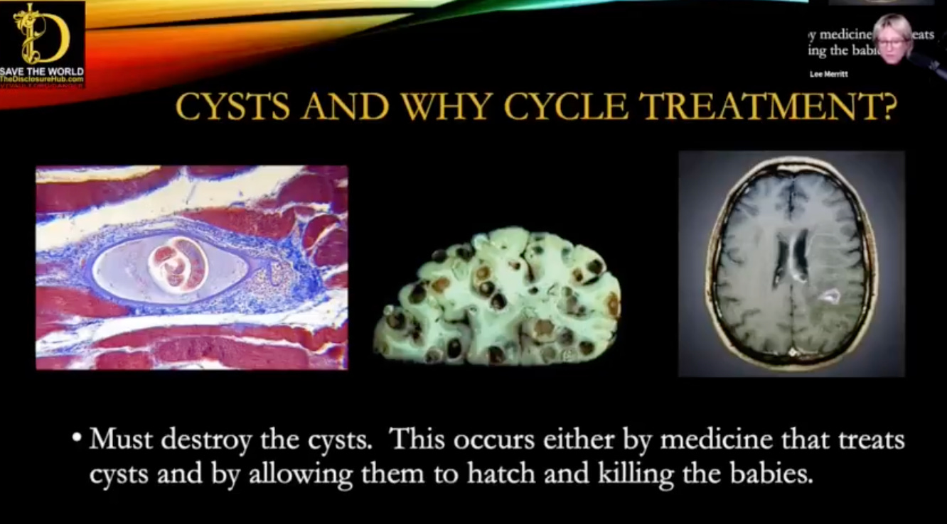 A Case for Ridding the Body of Parasites