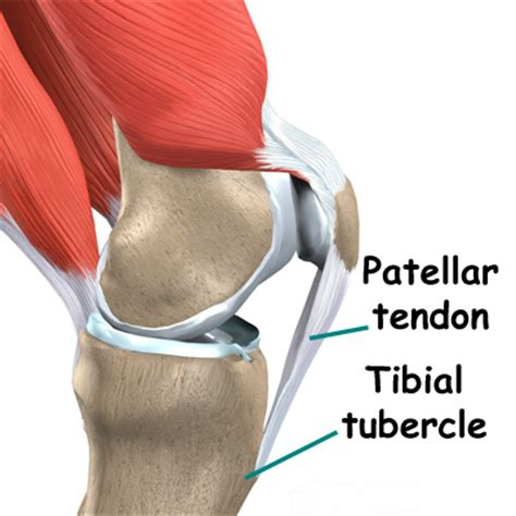 Using Isometrics to treat Patella Tendinopathy