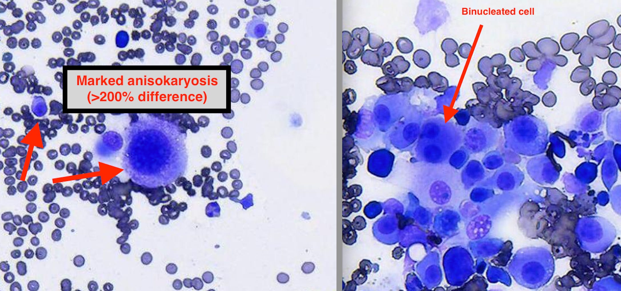 Can You Grade Canine Mast Cell Tumors on Cytology???