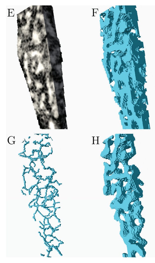 The cytoskeleton of dendrites forms a uniform gel in the spine neck and ...