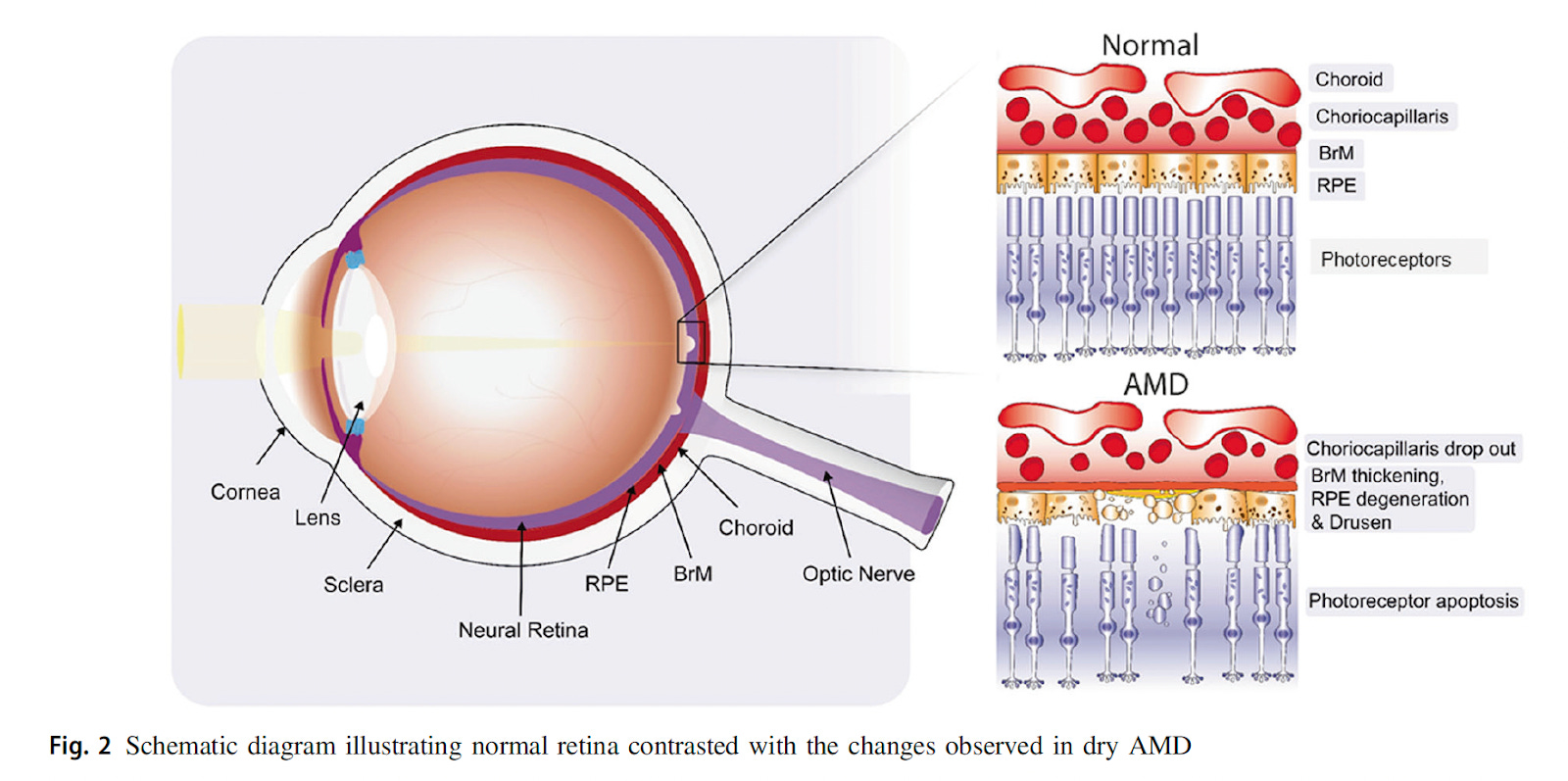 #021: Lineage Cell Therapeutics Deep Dive