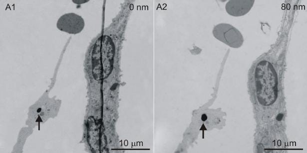 Combining x-ray tomography with serial section transmission electron ...