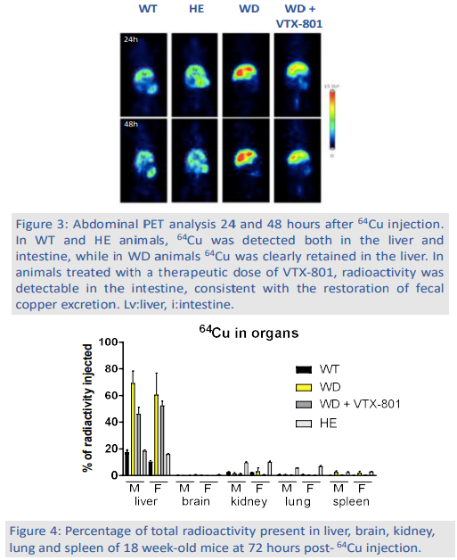 Wilson Disease: New Treatment Paradigm on the Horizon?