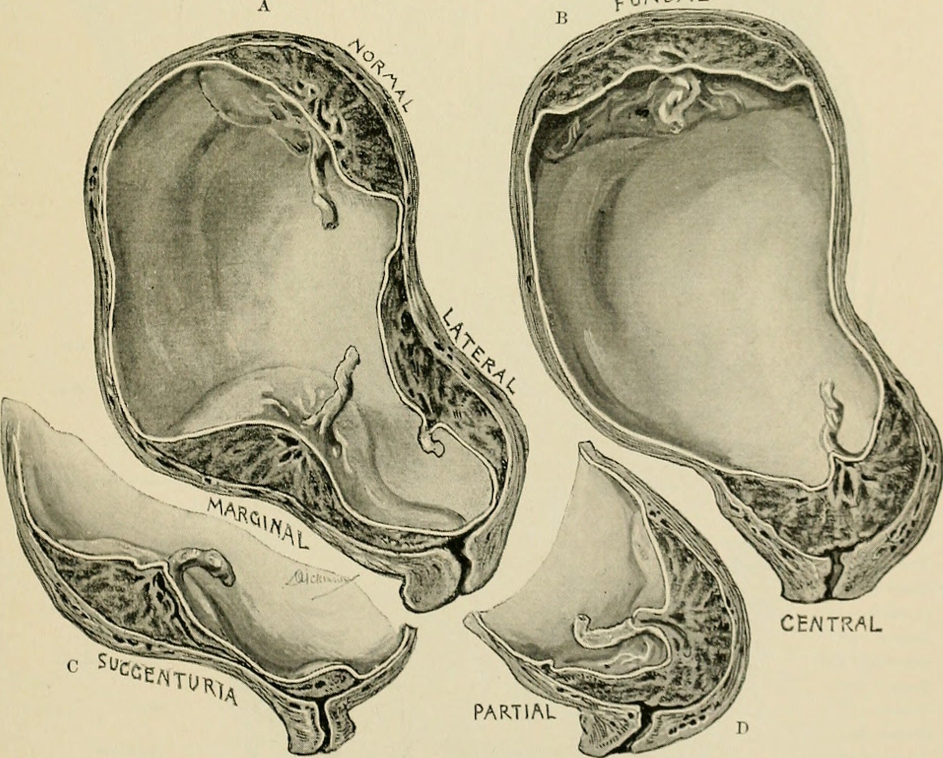 The Placenta and the Great Pregnancy Remodel - by MK