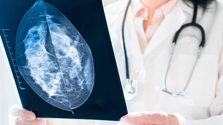 50% of Women Had a False-Positive Mammogram After 10 Years