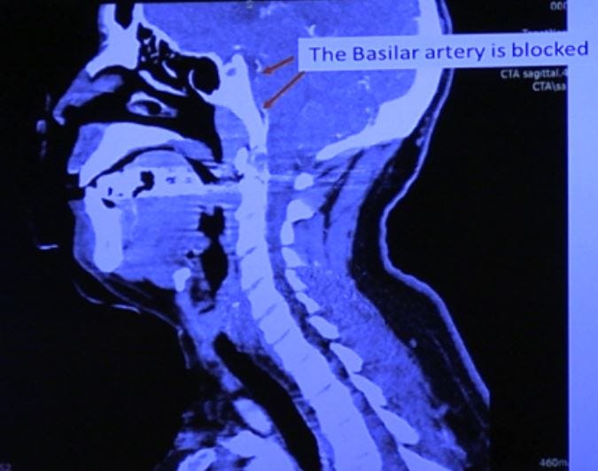 Locked-In Syndrome [Chiropractor Adjusts Neck]
