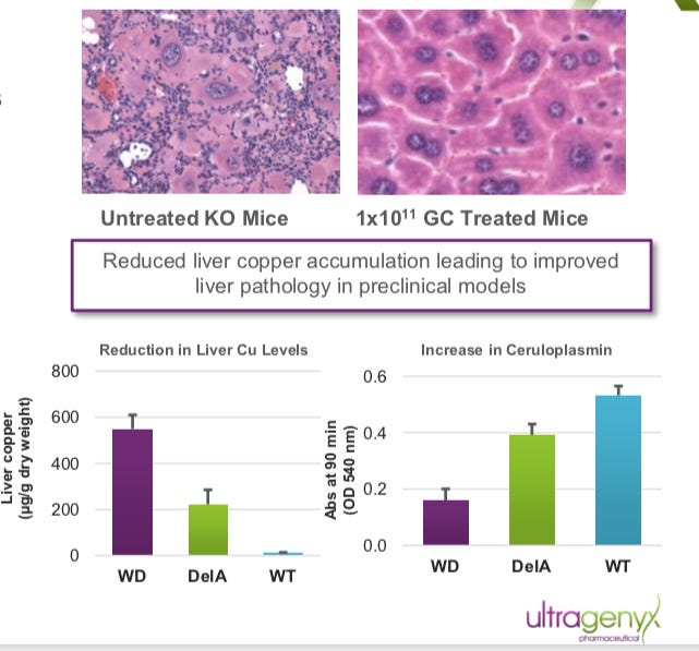 Wilson Disease: New Treatment Paradigm on the Horizon?