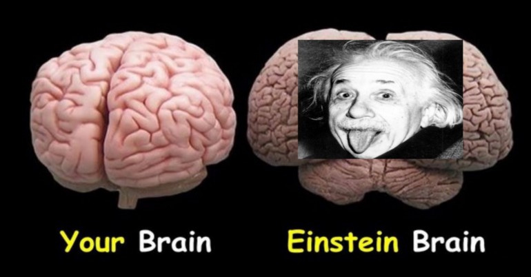 Einstein Brain