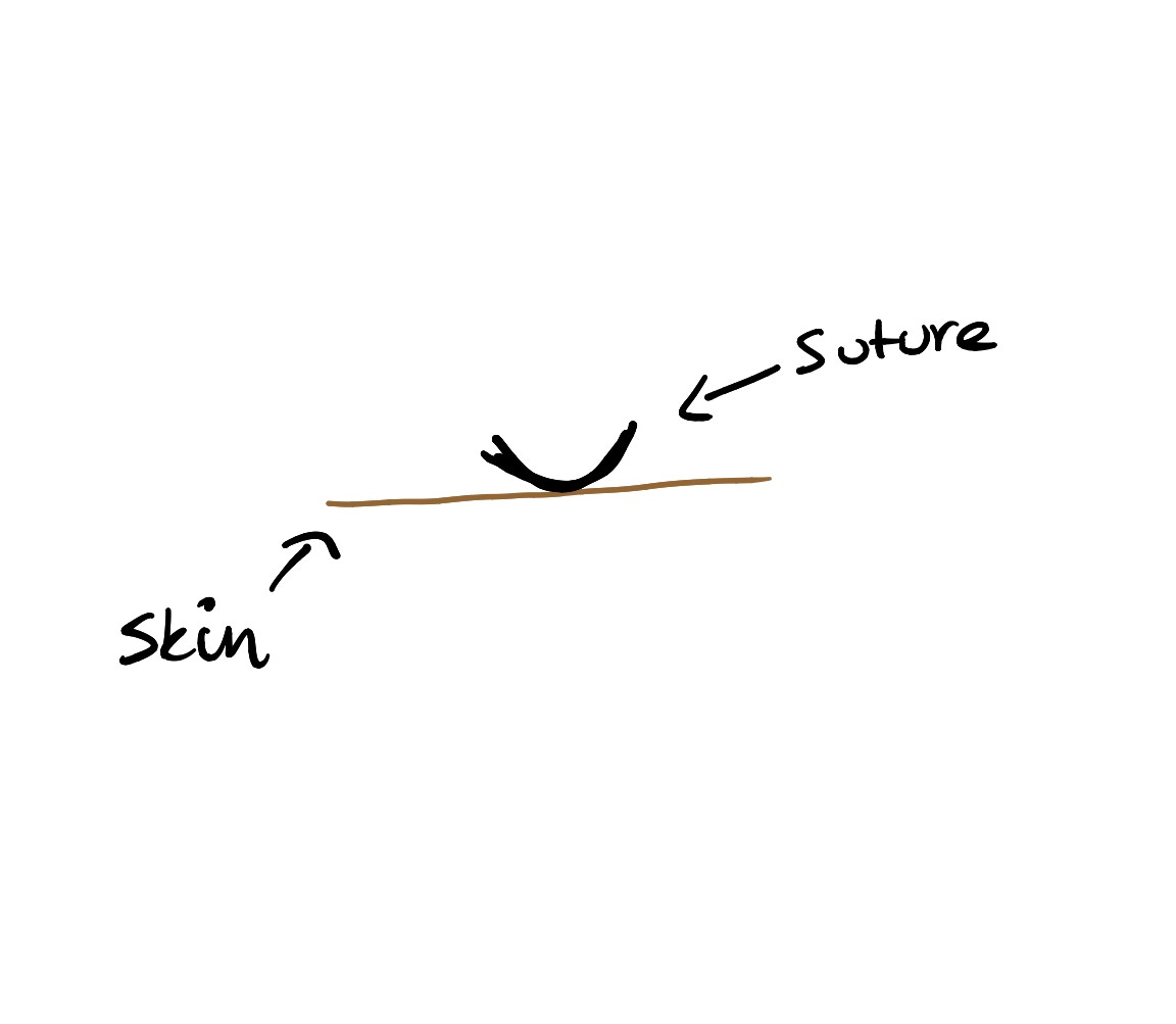 Removing sutures and calculating delivery dates