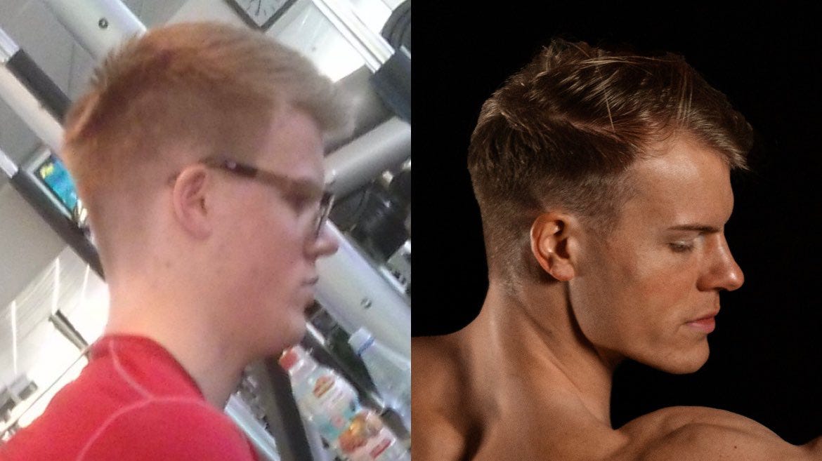 Is it Possible to Change the Shape of Your Face? A Tale of Two Jawlines ...