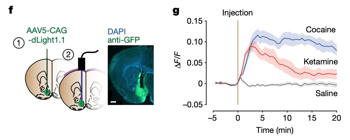 How Does Ketamine Work in the Brain & is it Addictive?