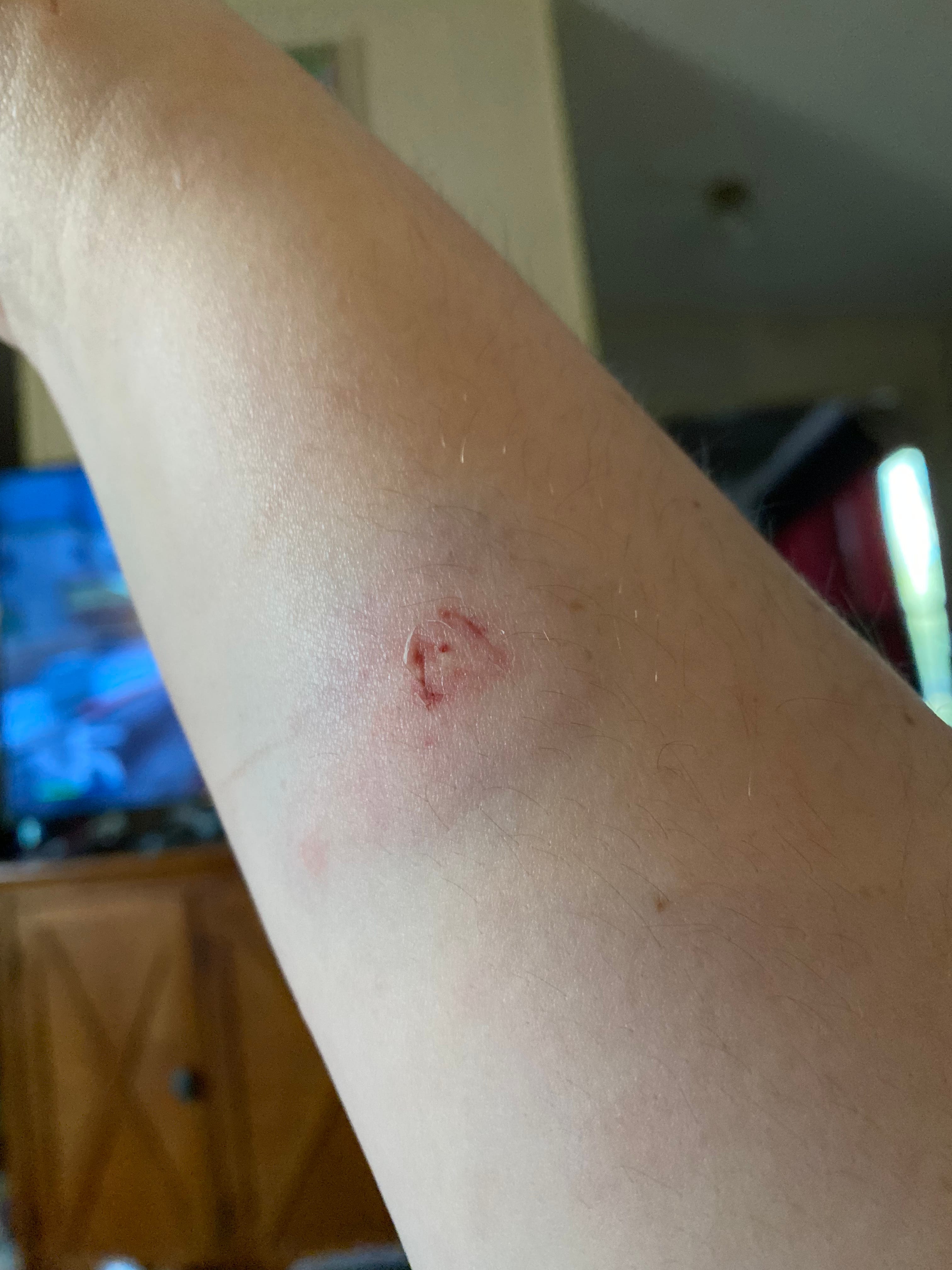 How hard do birds bite? - by Olivia - Browning's birds