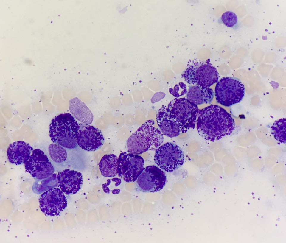 Can You Grade Canine Mast Cell Tumors on Cytology???