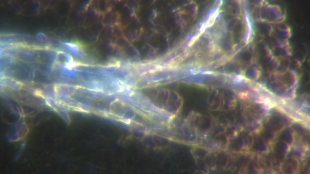 New Images of Self-Assembly Structures in Pfizer Vials and Live Blood ...