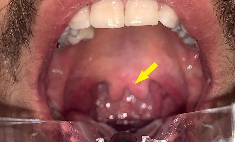 Científicos logran crear moco sintético, y es mucho más útil de lo que ...