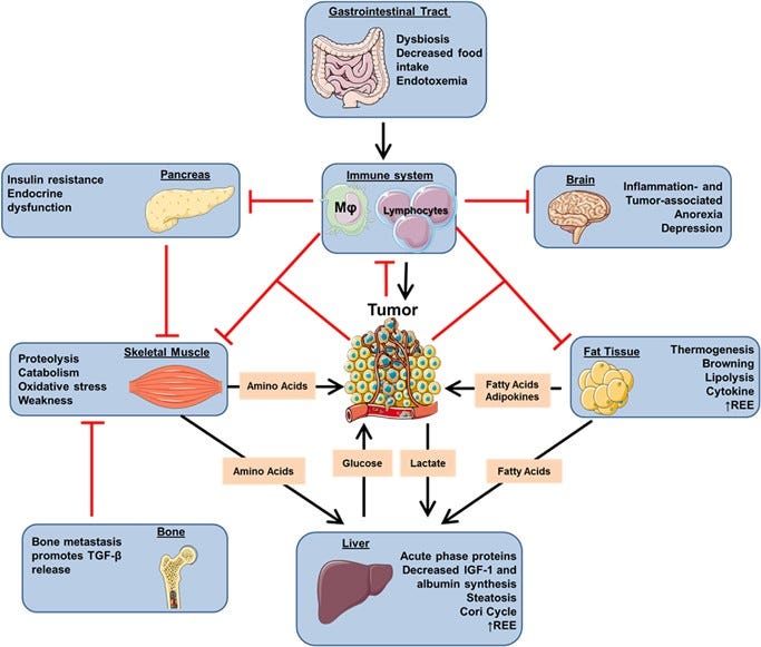 Understanding cachexia as a cancer metabolism syndrome