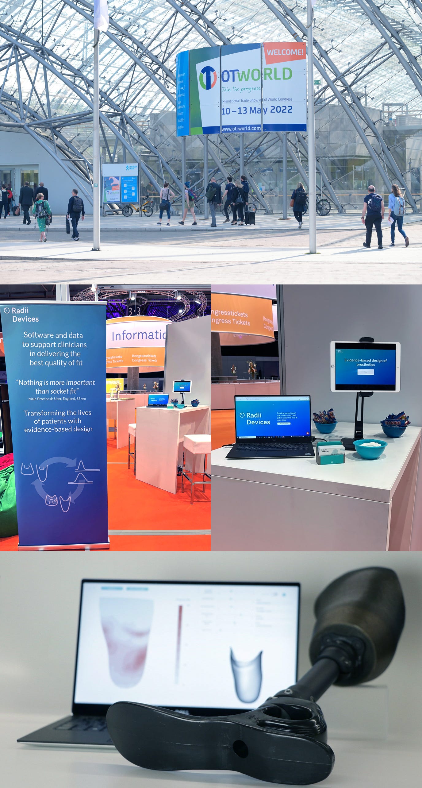 The Journey to Evidence-Based Socket Design