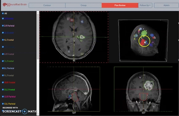 This "amateur" programmer fought cancer with 50 Nvidia Geforce 1080Ti