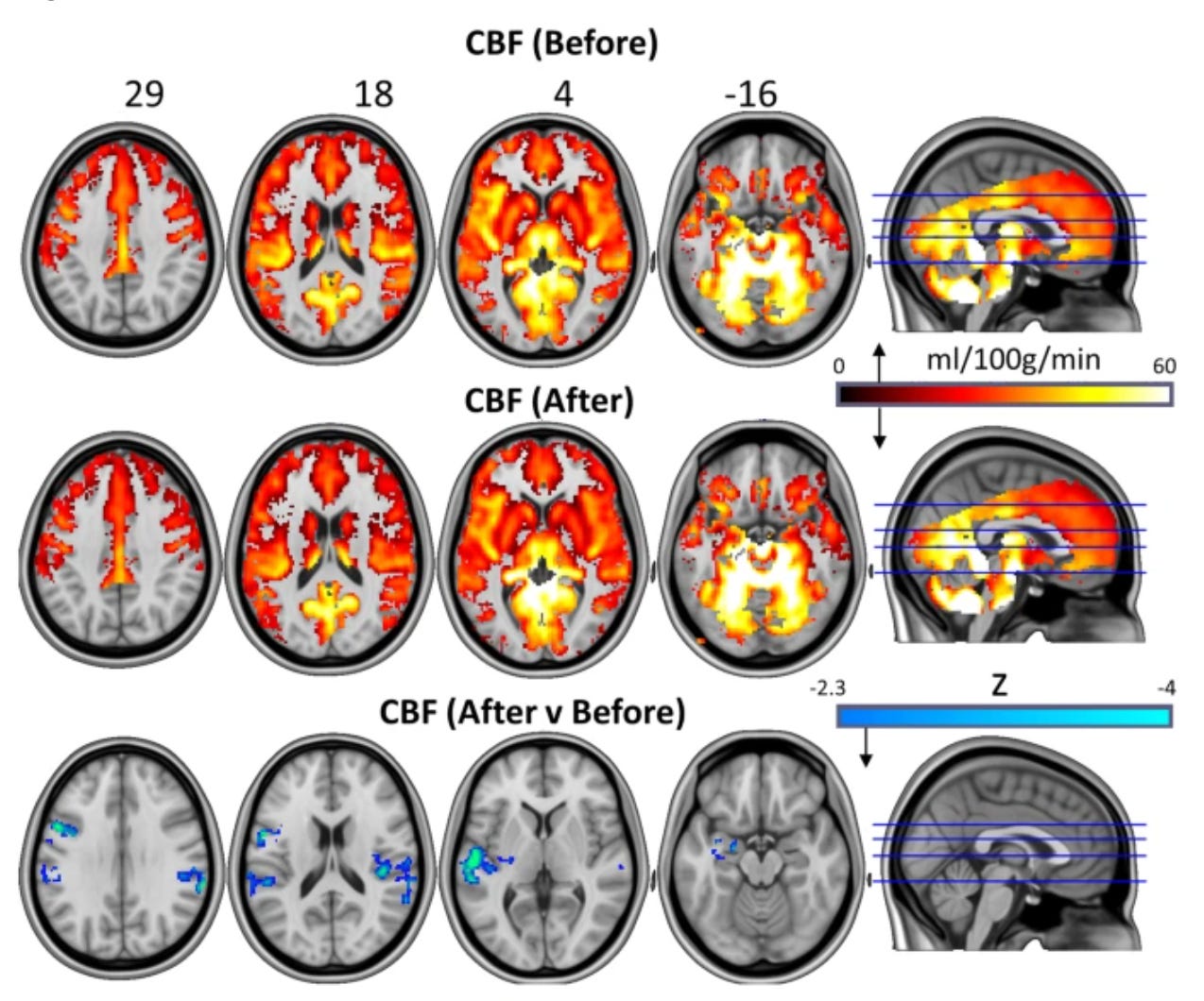 Nathan Howard: Mental health and mushrooms