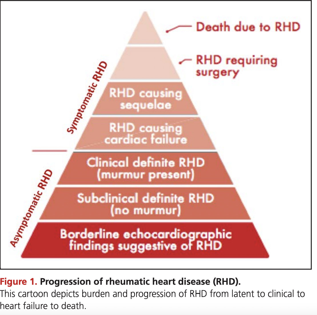 consensus guidelines of diagnosis and management of Rheumatic heart ...
