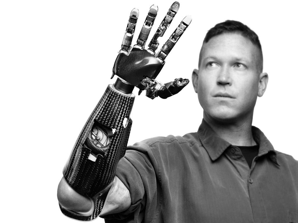 Case Study: Atom Limbs - The world’s first mind-controlled bionic arm.