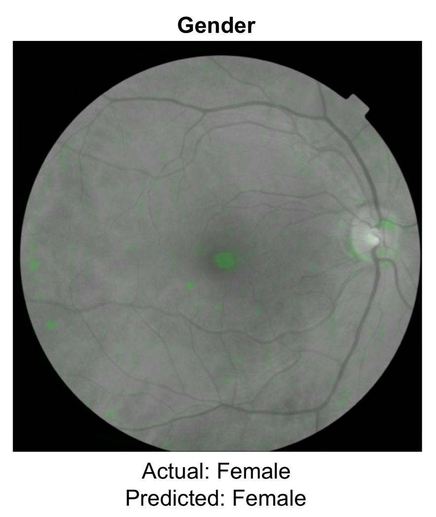 The amazing power of "machine eyes" - by Eric Topol