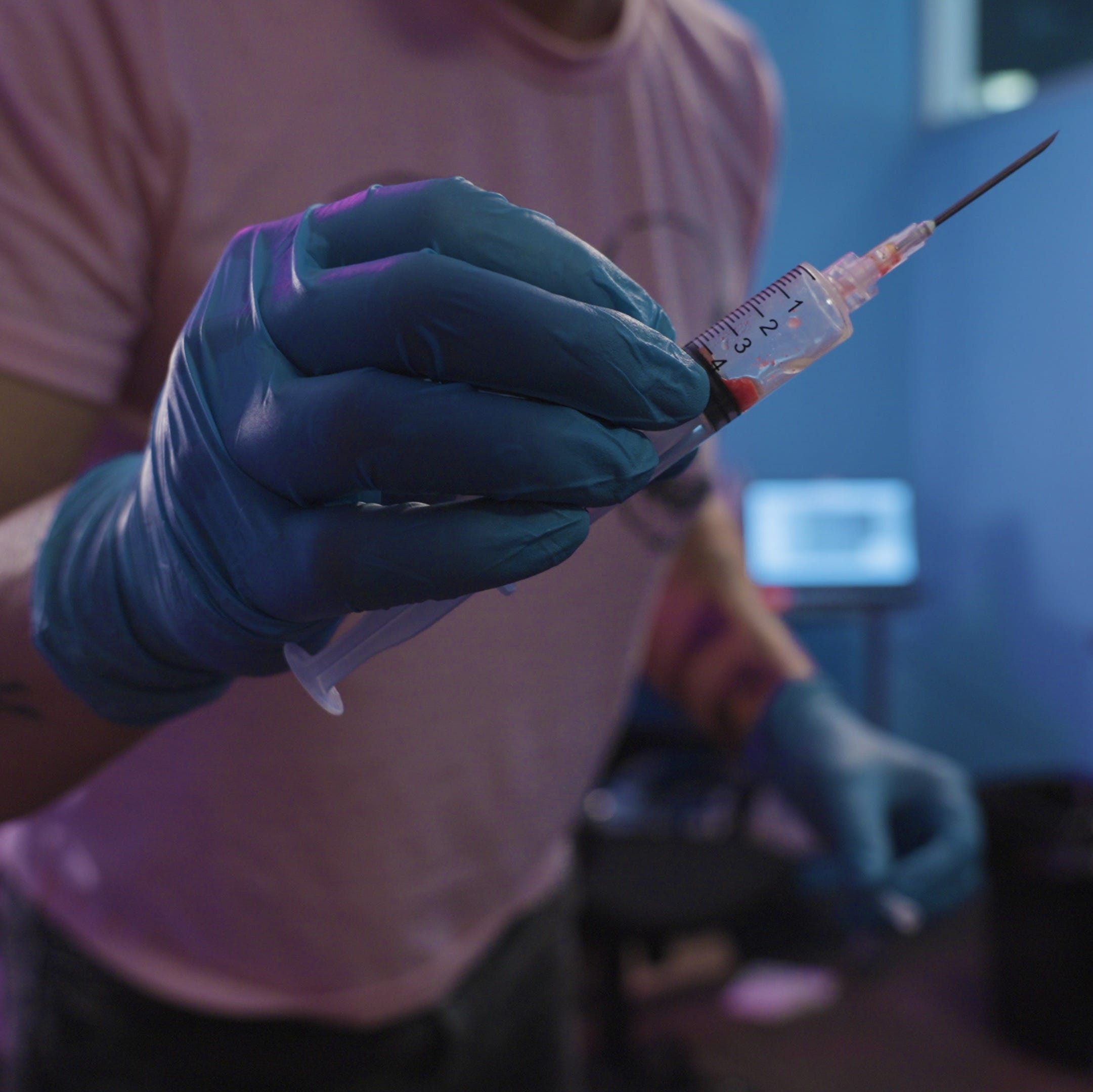 How to Extract and Grow Your Own Stem Cells - The ODIN