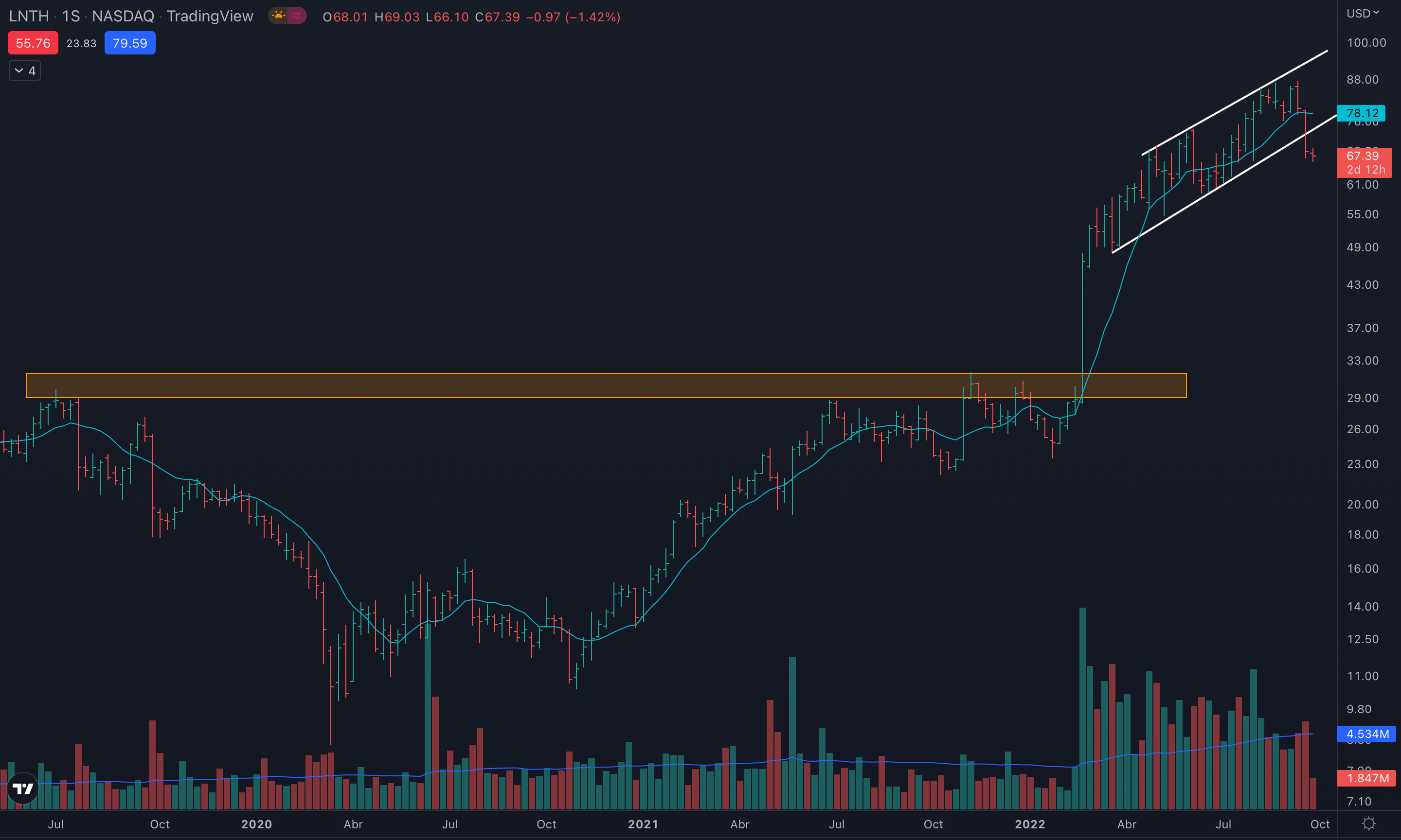Análisis de $LNTH (Lantheus Holdings) - by Izhan Juárez Análisis de $LNTH (Lantheus Holdings) - by Izhan Juárez