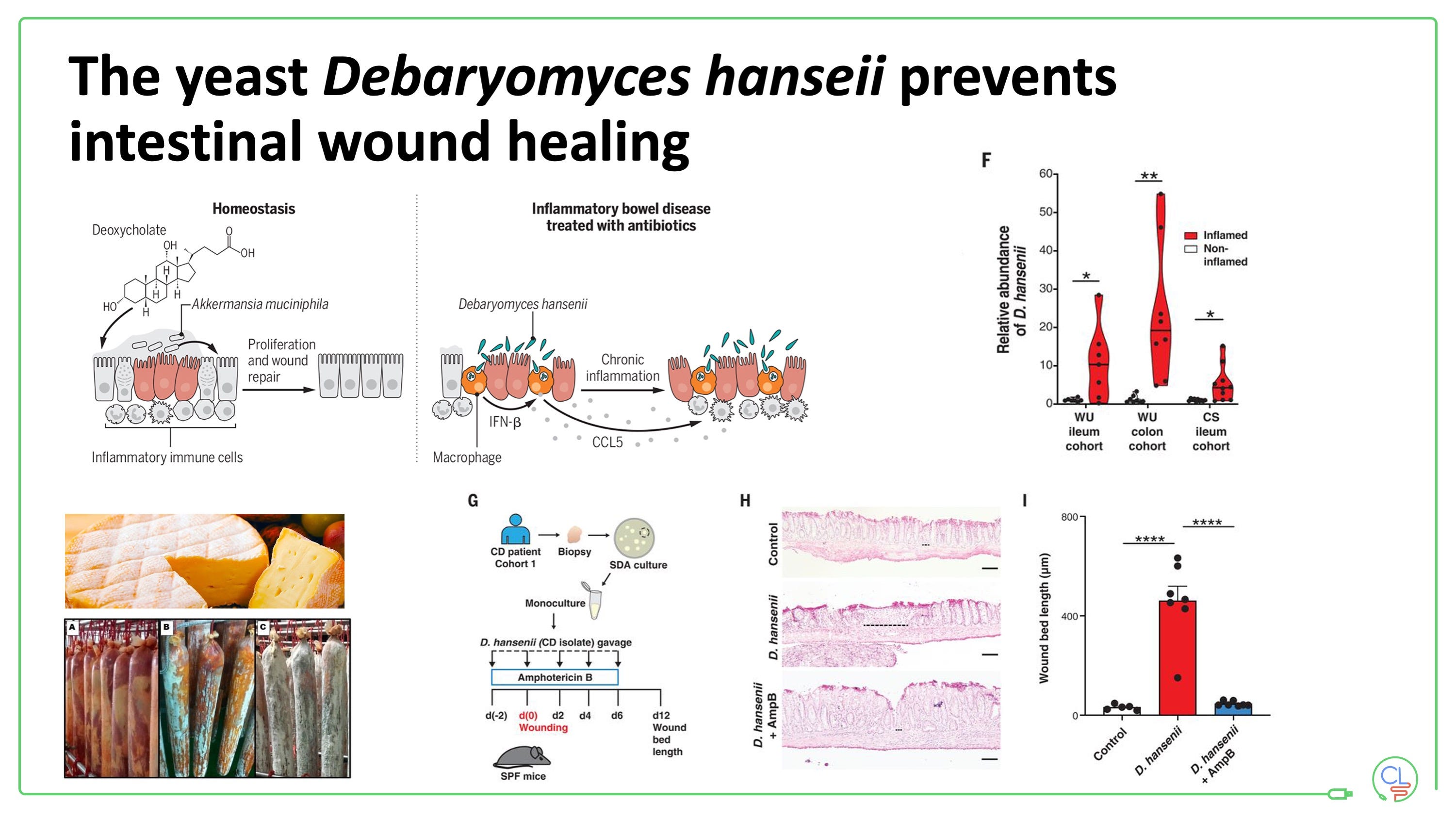 IBD at the start of 2023: part 1 - exploring gut inflammation research