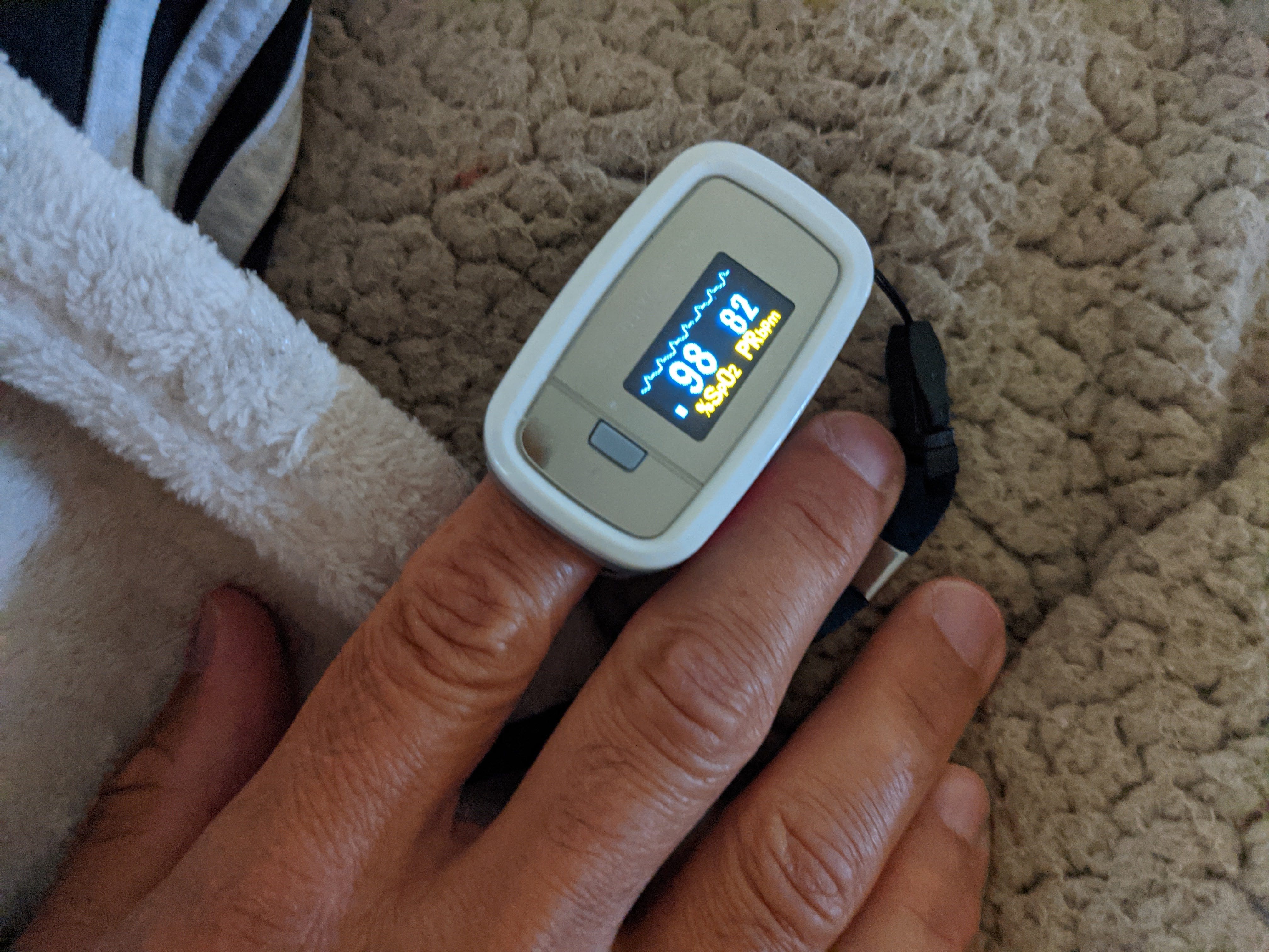 COVID Cytokine Waves vs Clotting Waves