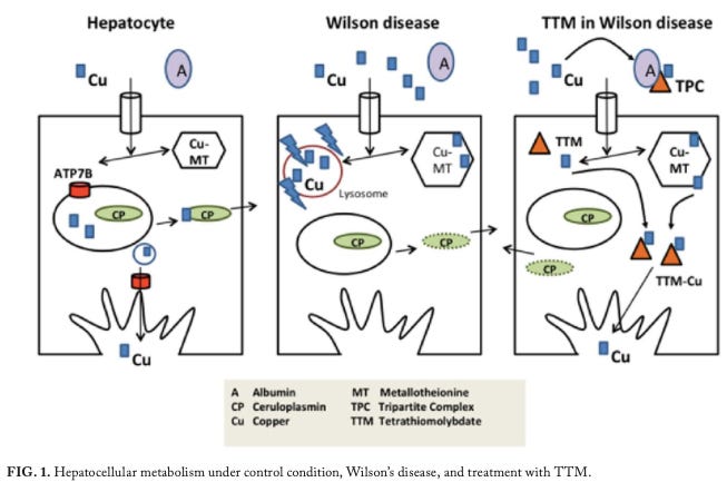 Wilson Disease: New Treatment Paradigm on the Horizon?