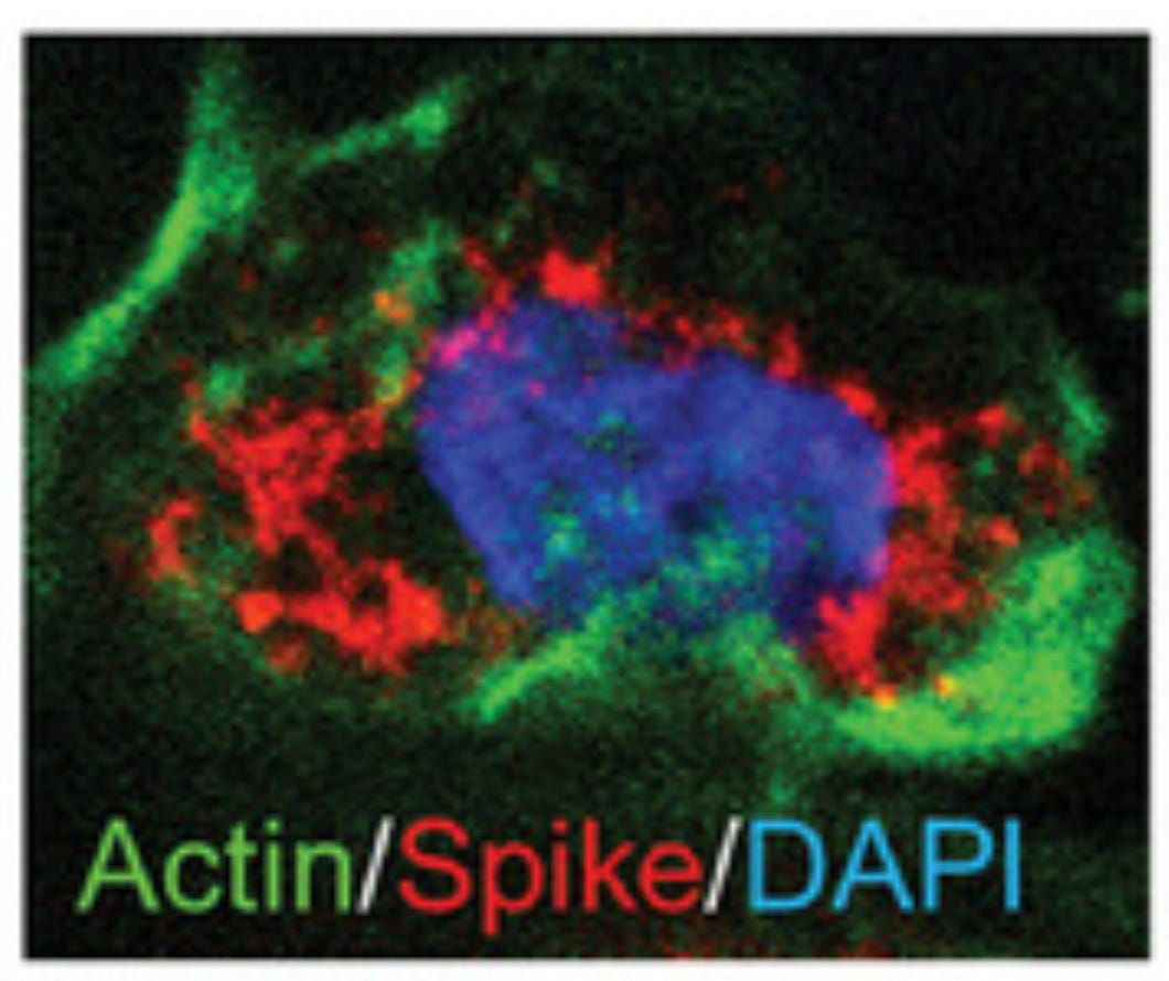 Does spike protein get into the nucleus of cells?