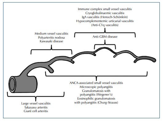 ANCA and ANCA-associated vasculitis after mass vaccination