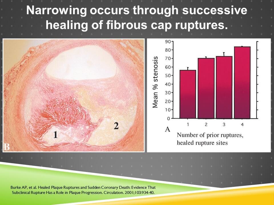 12. Oxidative Stress and Heart Disease