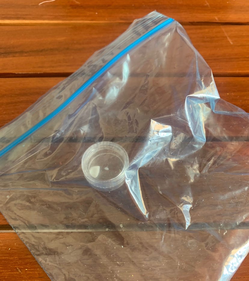 The Bride Lost a Tooth?? - by Kelsey Willock