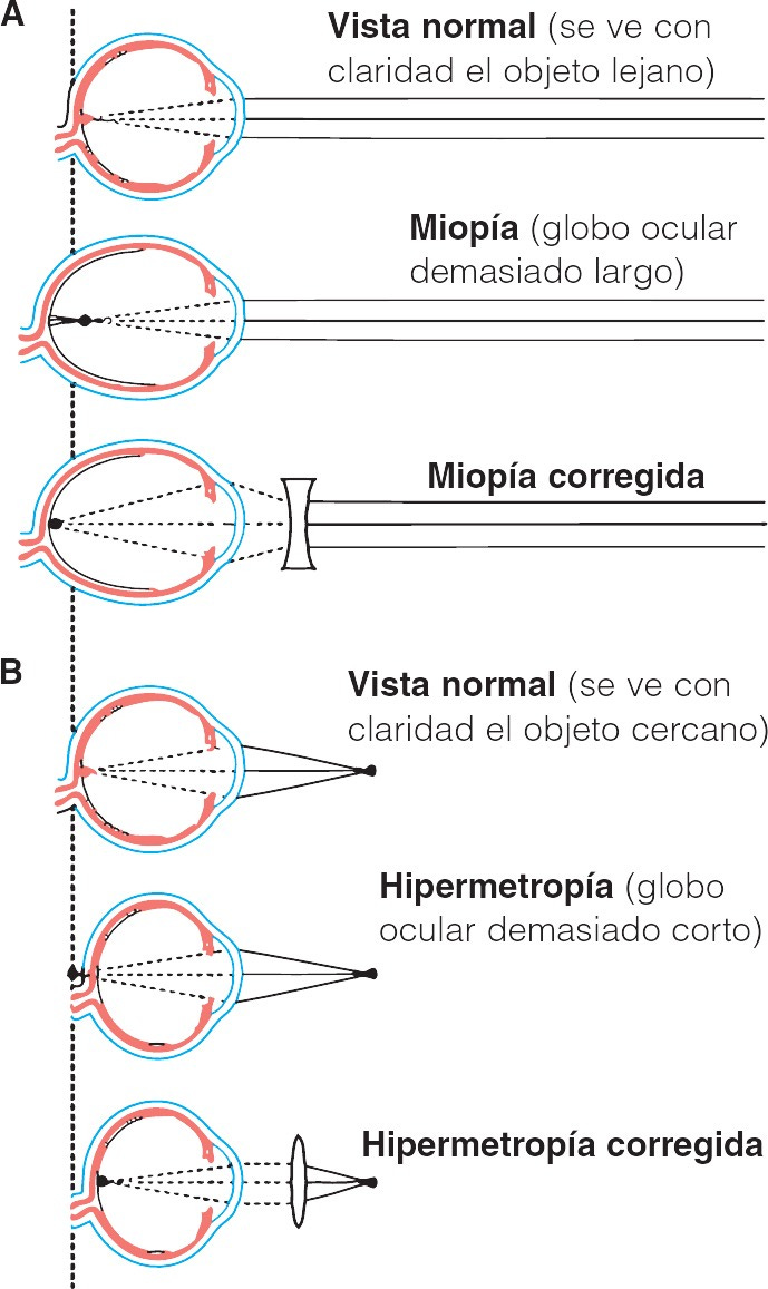 Examen oftalmológico - by Harold Ferraz - Medical Student
