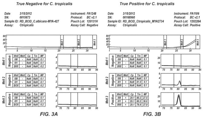The BioFire FilmArray - by Nava Whiteford - ASeq Newsletter