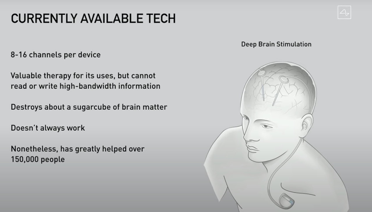 我看neuralink - by matt - 10x Random Thoughts