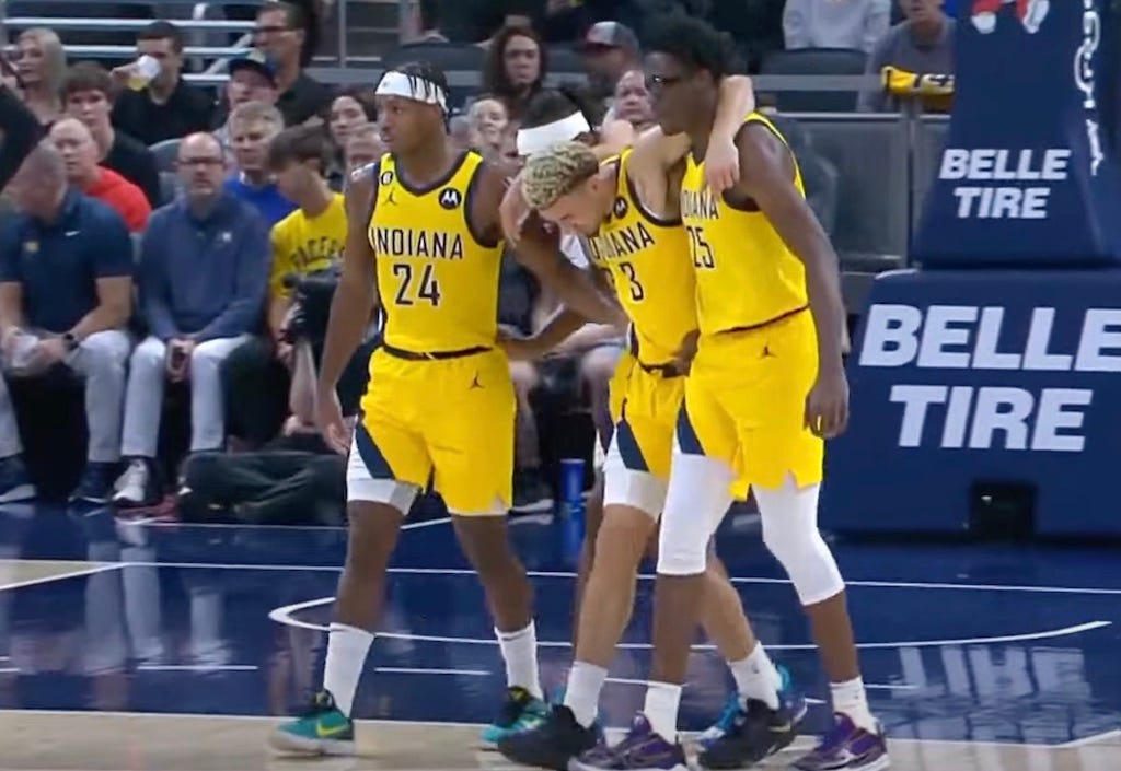 Pacers guard Chris Duarte sidelined indefinitely with left ankle sprain