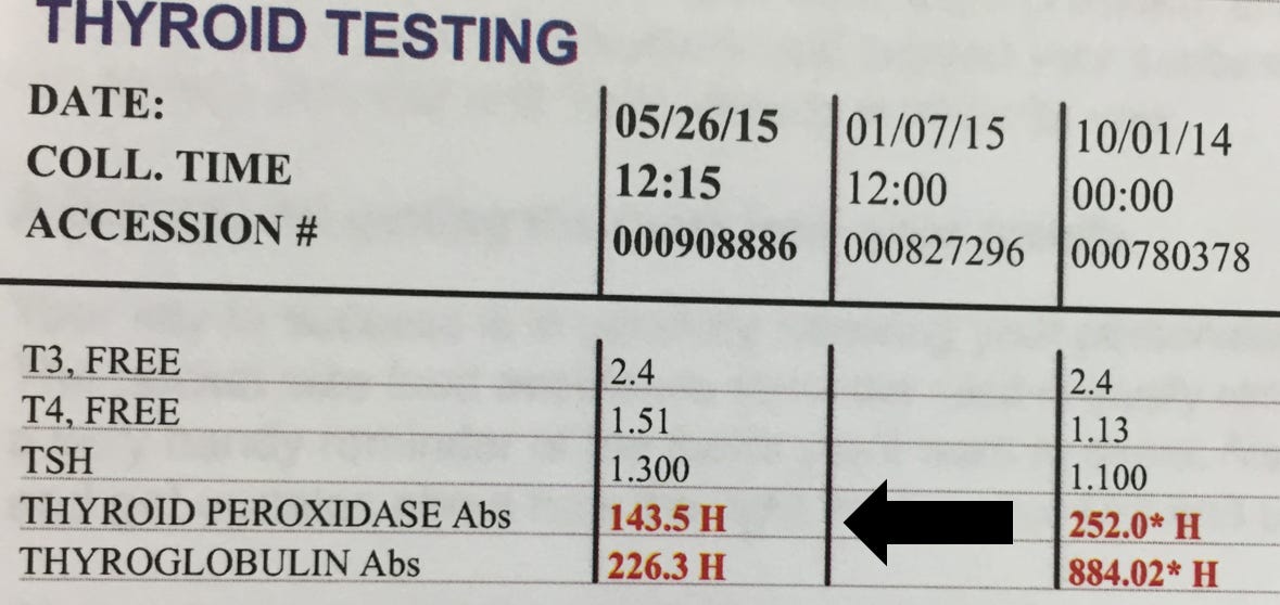 Thyroid Stimulating Hormone (TSH) - by Dr. Alex D. Grubish
