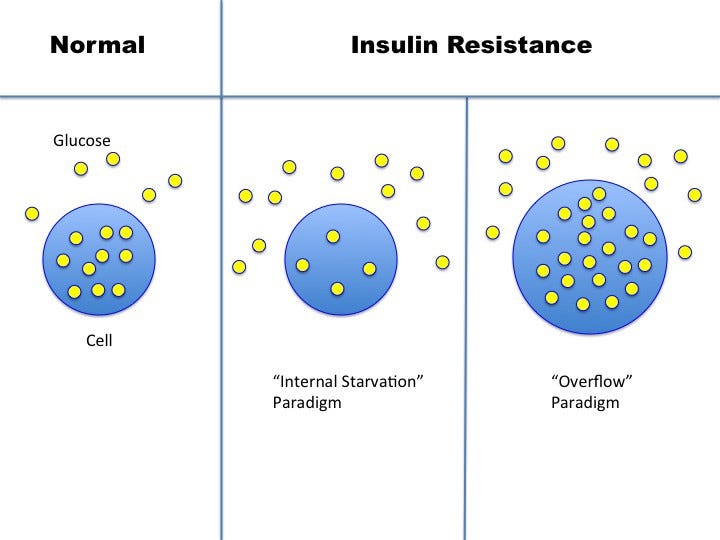 What, exactly, is insulin resistance? - by Dr. Jason Fung