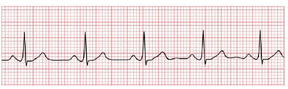 Rhythms of the heart - by Mariah Friend - Heartbeats